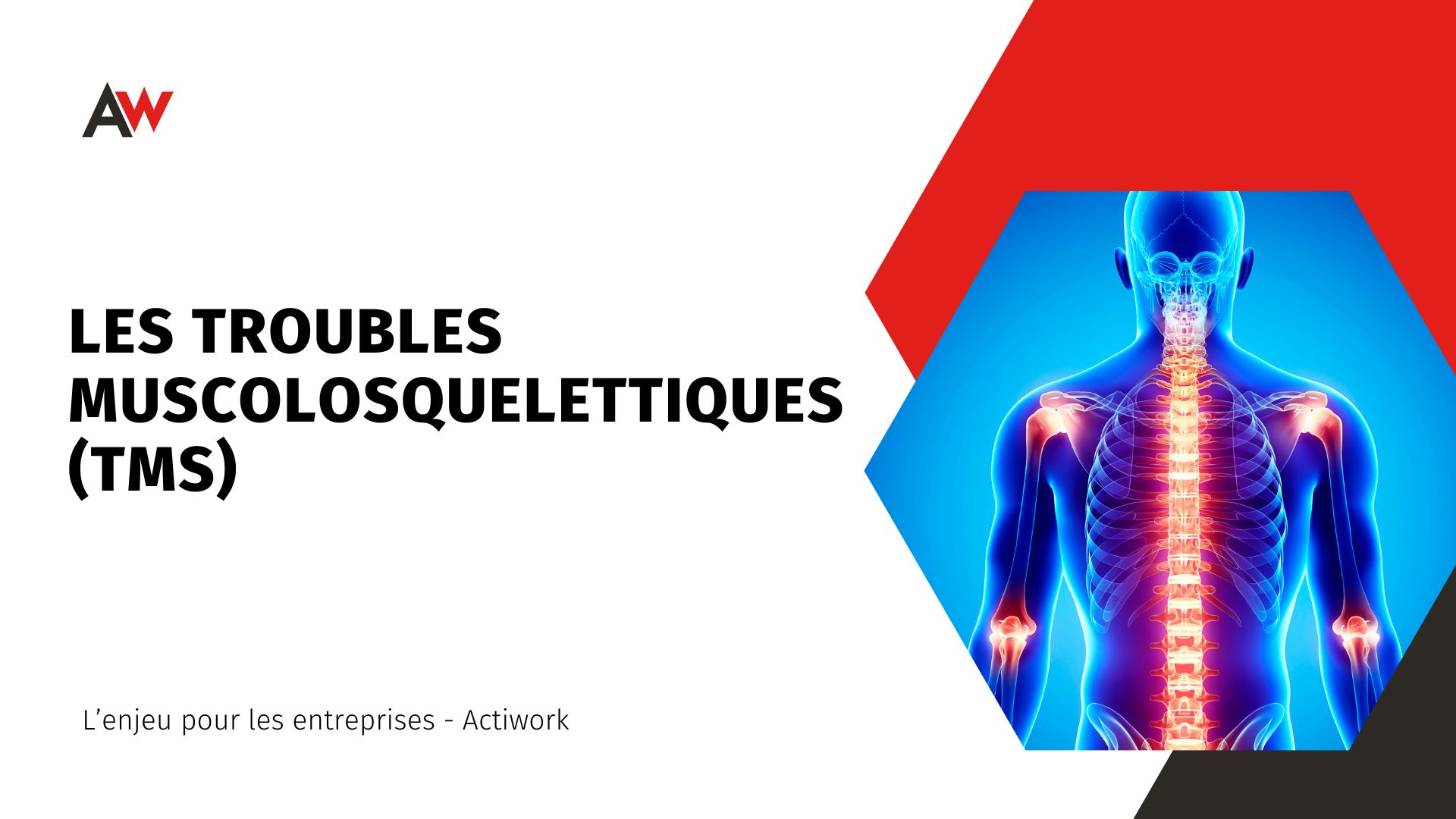 Les Troubles Musculosquelettiques (TMS) | Actiwork